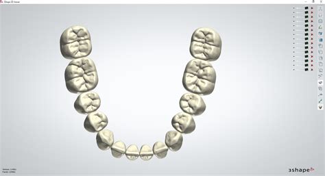 🩻 3shape Open Library Ap Natural・ 3d File For 3d Printing・cults