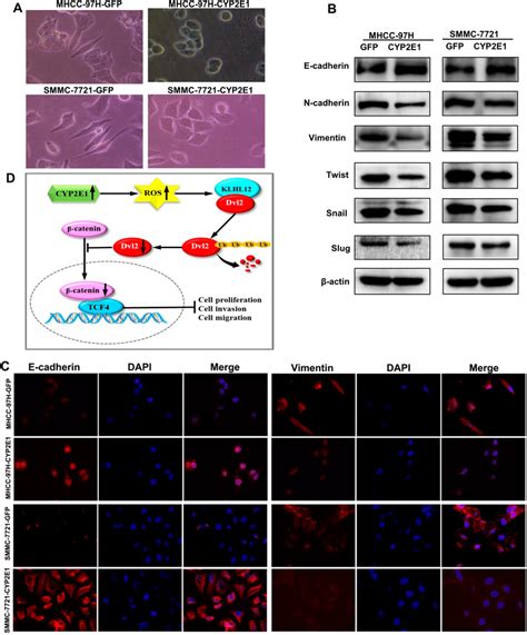 Overexpression Of Cyp2e1 Inhibits Emt In Hcc Cells A Representative