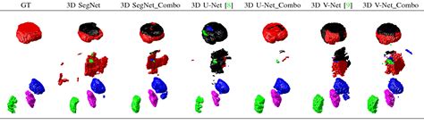 Combo Loss Handling Input And Output Imbalance In Multi Organ Segmentation