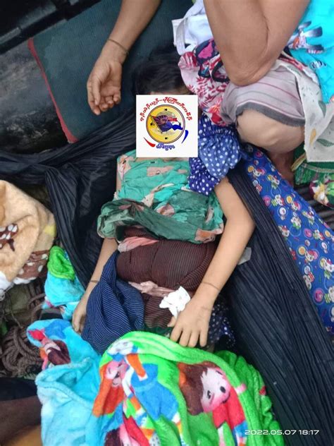 Knu တပ်မဟာ ၅ နယ်မြေအတွင်းရှိ ကူးဆိပ်အခြေစိုက် ခမရ ၄၀၈ က ပစ်ခတ်သော လက်နက်ကြီး ထိမှန်ပြီး ပြည်သူ ၁