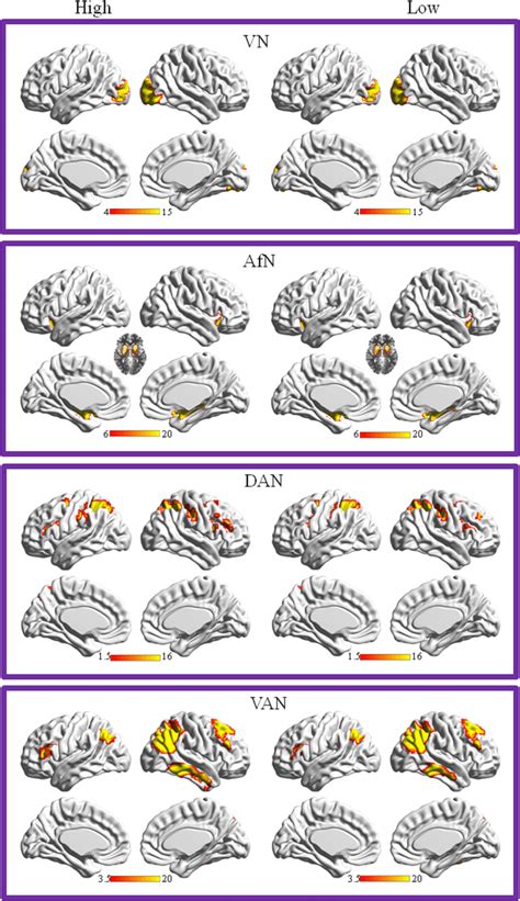 Cortical Representation Of The Four Rsns Of Resting State Fmri Data Download Scientific Diagram