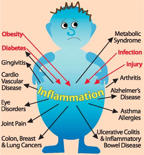 Measure Inflammation Suson Essentials