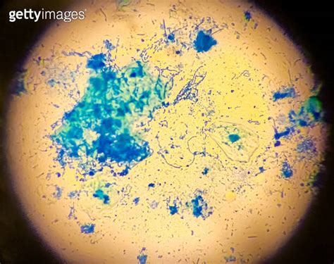Bacterial Cells Chains Streptococcus Pyogenes Photo From Microscope 이미지 2161635894 게티이미지뱅크