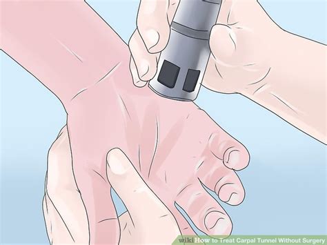 4 Ways To Treat Carpal Tunnel Without Surgery Wikihow