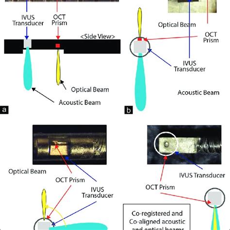 Four Different Types Of Hybrid Intravascular Ultrasoundoptical Download Scientific Diagram