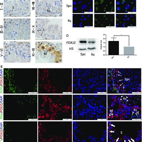 Analysis Of The Transcriptome Alteration In The Testes Of Stra8 Cre