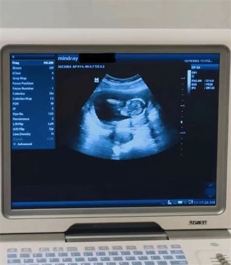 Ireland Baldwin Pregnant Alec Baldwins Daughter 27 Expecting First