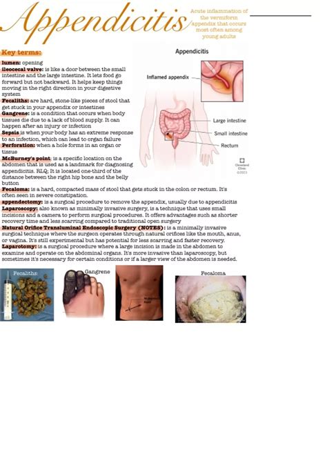 Class Notes Nur 1111 Medical Surgical Nursing E Book Appendicitis