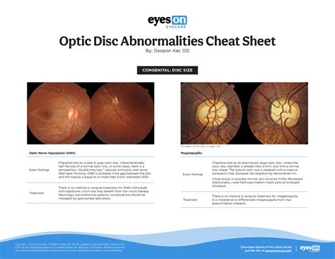 Optic Disc Findings At Donald Mccann Blog