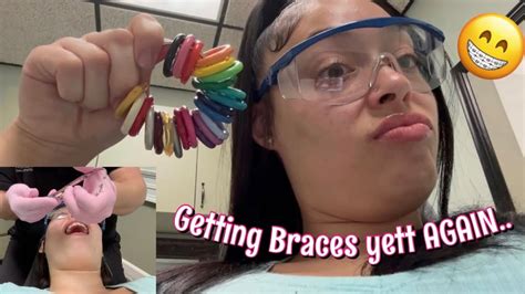 Come With Me To Get My Braces💘 Youtube