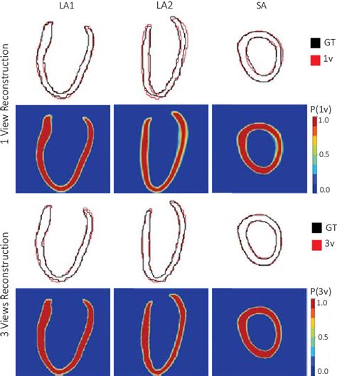 3d High Resolution Cardiac Segmentation Reconstruction From 2d Views Using Conditional
