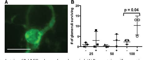 Figure 1 From Tissue Engineered Microvasculature To Reperfuse Isolated Renal Glomeruli
