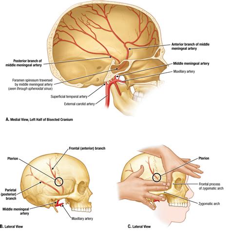 Foramen Spinosum Middle Meningeal Artery