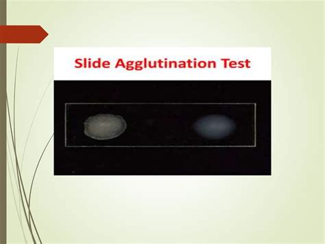 Serological Techniques For Detection Of Plant Viruspptx
