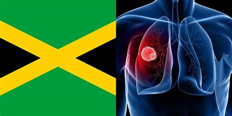 Lung Cancers In Jamaica
