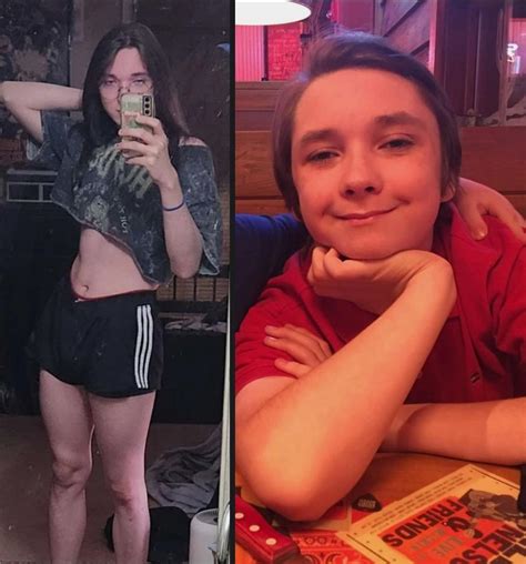 7 Years Hrt Right Vs 1 Week Hrt Left Rtranstimelines