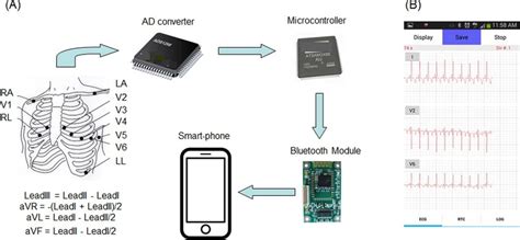 The Smartphone Based Ecg Acquisition System Or Cvrphone The Download Scientific Diagram