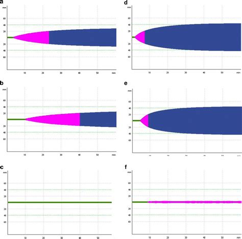 Thromboelastometry Analysis Rotem® At The Beginning Of The Cesarean Download Scientific