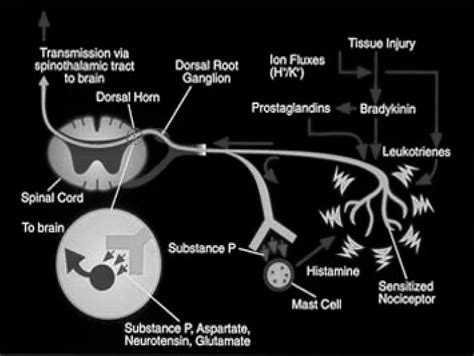 Nociceptor Silencioso Ecured