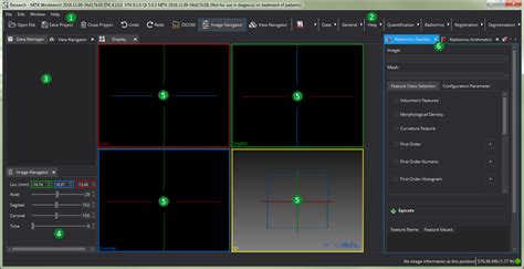 Medical Imaging Interaction Toolkit Gui Based Radiomics Tutorial