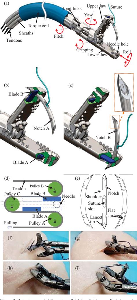 Figure 1 From A Novel Robotic Suturing System For Flexible Endoscopic Surgery Semantic Scholar