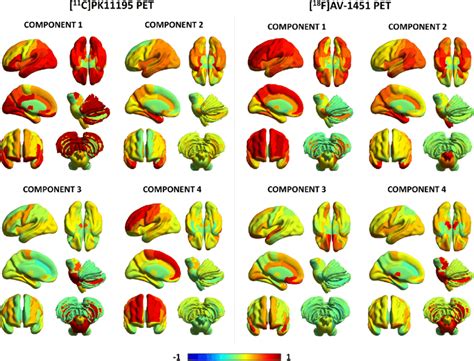 First 4 Principal Components For 11 C Pk11195 Non Displaceable Download Scientific Diagram