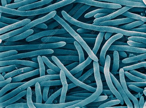 Heliobacteria Sem Stock Image C0562280 Science Photo Library