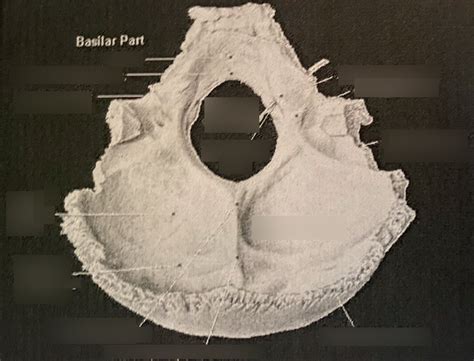 Occipital Bone 1 Diagram Quizlet