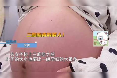 90后女子怀上三胞胎肚子大到坐着都直喘气自述孕后经历泪目