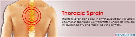 Thoracic Sprain Treatment Exercise Prevention Symptoms