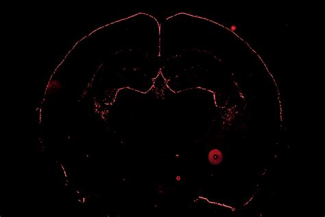 The Brains “stalwart Sentinels” Express An Unexpected Gene The Transmitter Neuroscience News