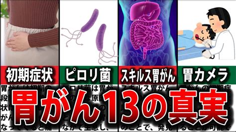 胃がんの質問にすべて答えます初期症状 ピロリ菌 スキルス胃がん 完治 予防 早期発見 費用 末期 検診 治療 余命 YouTube