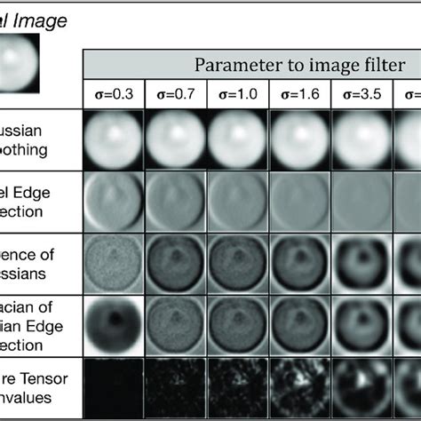 The U Net Convolutional Neural Network Cnn Architecture Was Developed Download Scientific