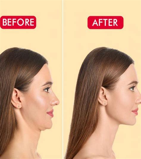 Neck Stretching Before And After