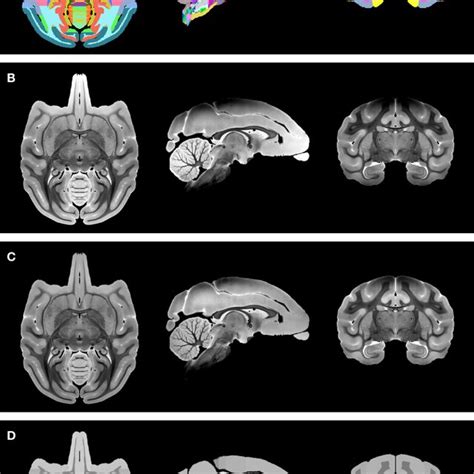 Preparation Of The Neuromaps Label Map And Mr Image A Symmetric