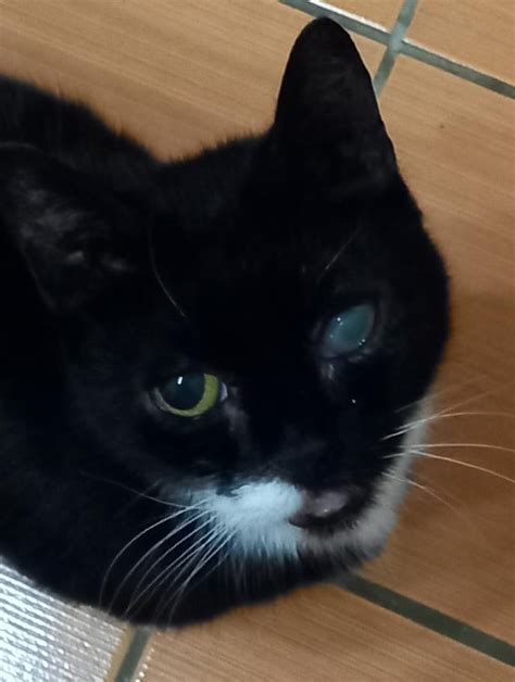 Suspicion On Ocular Fip Rcurefip