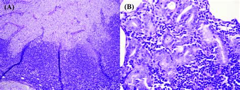 Lymph Node Microscope Slide