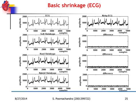 PPT Wavelet Based Subband Shrinkage Models And Their Applications In Denoising Of Biomedical