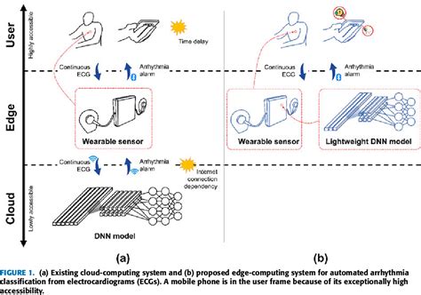 Figure 1 From Automated Arrhythmia Classification System Proof Of Concept With Lightweight