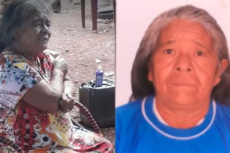 Feto mumificado há anos pode ser gêmeo desaparecido diz obstetra