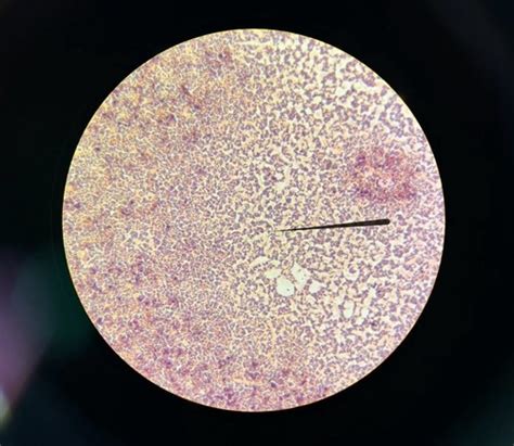 Bio 305 Practicum 1 Flashcards Quizlet