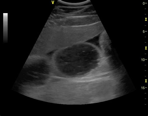 Uso do lactato como marcador diagnostico e prognostico na cólica equina