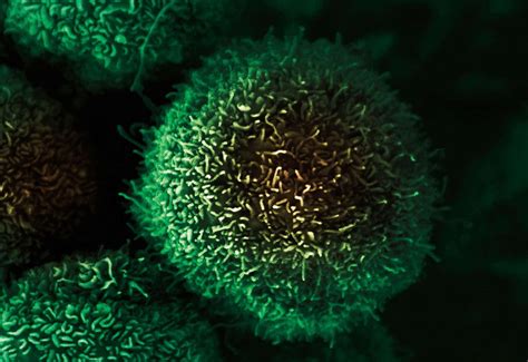 Cancérologie une piste s ouvre contre le cancer du pancréas Science