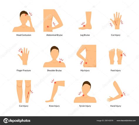 Ilustracion Del Cuerpo Humano Y Sus Dolores En Ingles