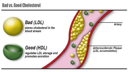 CHOLESTEROL Is It Good Or Bad