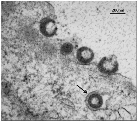 Varicella Zoster Virus Infectious Cycle Er Stress Autophagic Flux