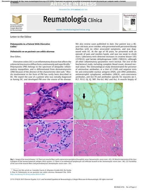 Pdf Polymyositis In A Patient With Ulcerative Colitis