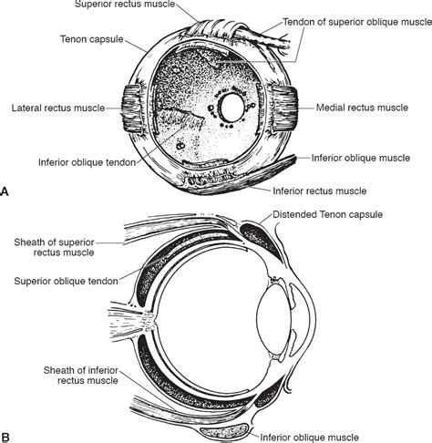 Tenons Capsule