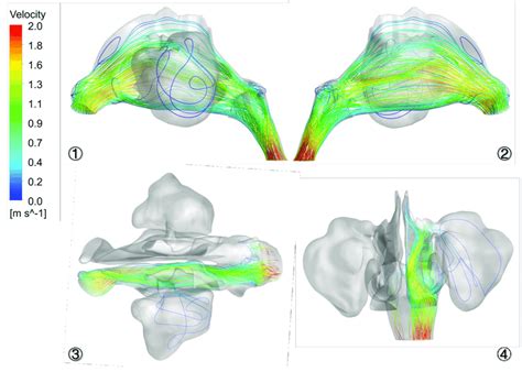 Airflow Streamline Track In The Nasal Cavity Under The 15 Lmin Download Scientific Diagram