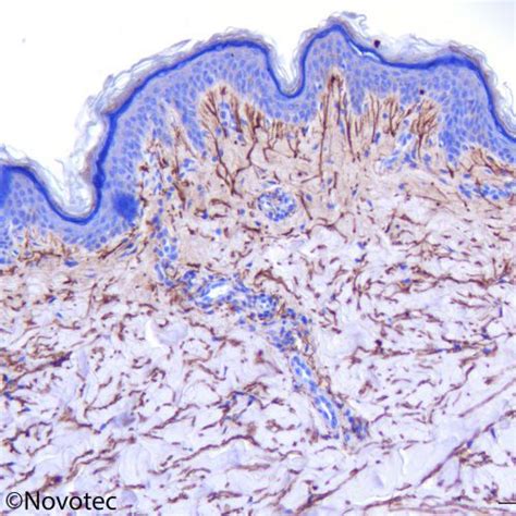 Aging In The Dermis Fibroblast Senescence And Its Significance Via
